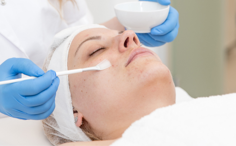 Jessner Peel | Chemical Peel | Aspire Training Clinic