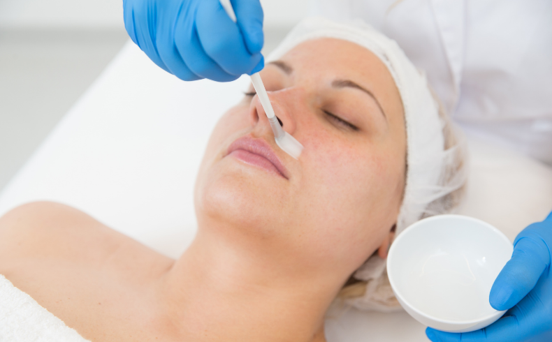 AHA Peel | Treatment | Chemical Peel | Aspire Training Clinic